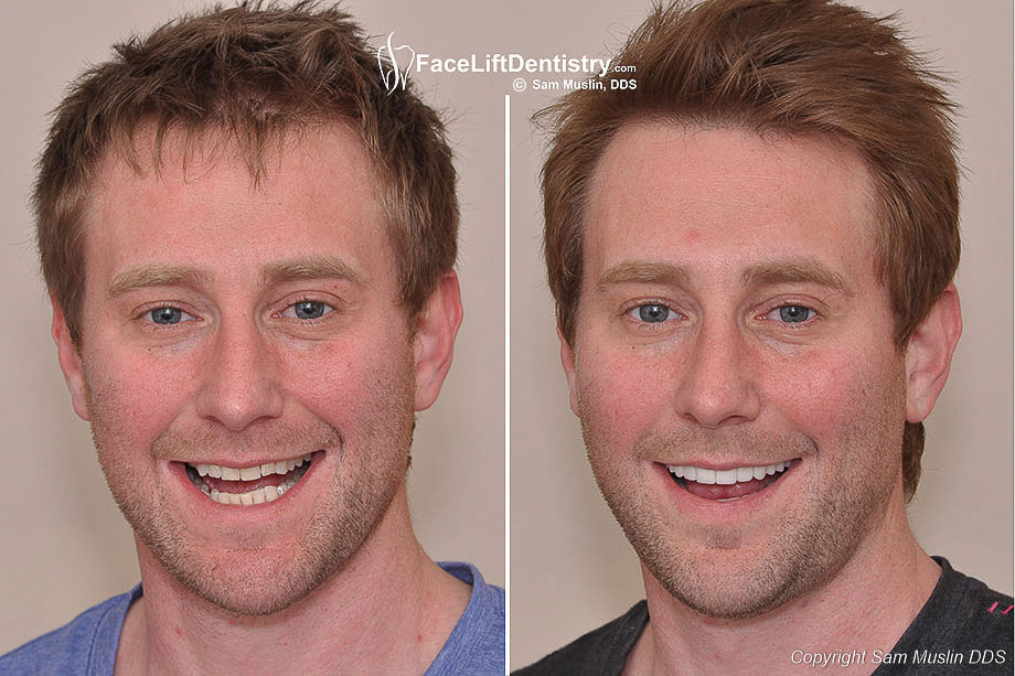 Best Cosmetic Dentistry